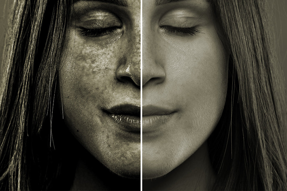 Ombra Del Sole 101 – Benedetta Skin Care